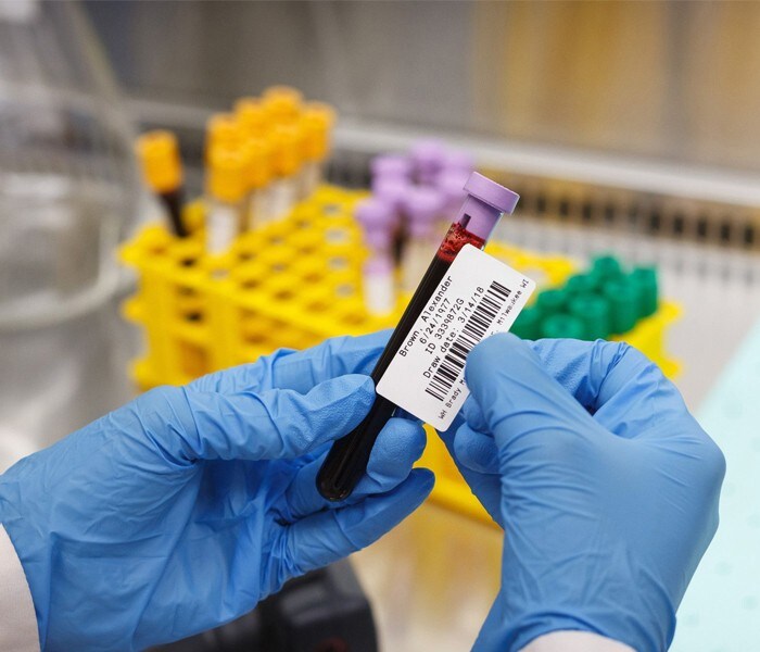 Sample Identification